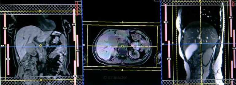 تکنیک MRI کبــد - MriNext