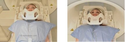 تکنیک MRI ستون فقرات گردن - MriNext