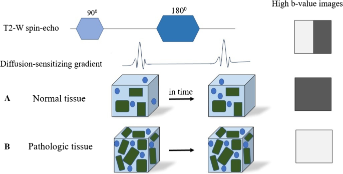 سکانس DWI - MriNext