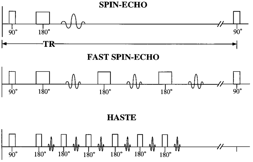 سکانس HASTE - MriNext