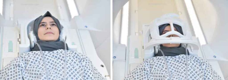 ام ار آنژیوگرافی مغز - MriNext