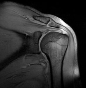 سکانس MEDIC - MriNext