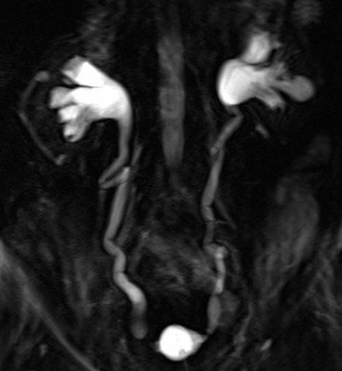 سکانس HASTE - MriNext