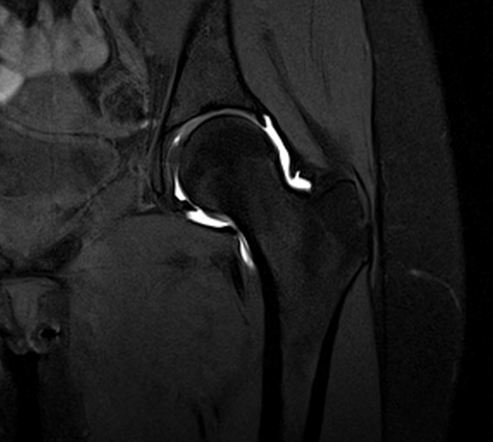 تصویر بر وزن T1 FAT-SAT، پس از تزریق ماده حاجب - MriNext