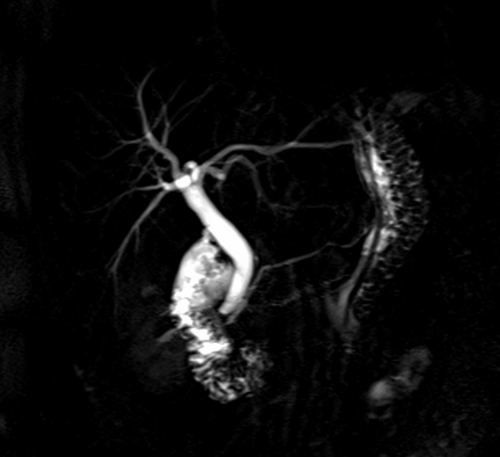 سکانس HASTE - MriNext