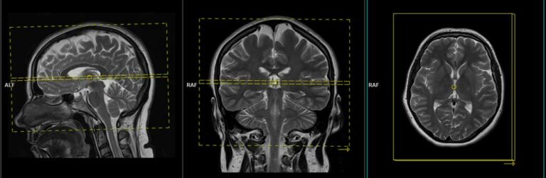 تکنیک MRI مغز - MriNext