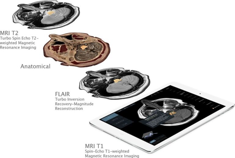 آناتــومی مقطعی - MriNext