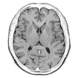 آناتــومی مقطعی - MriNext