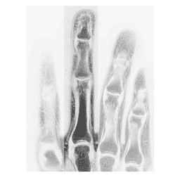 آناتــومی مقطعی - MriNext